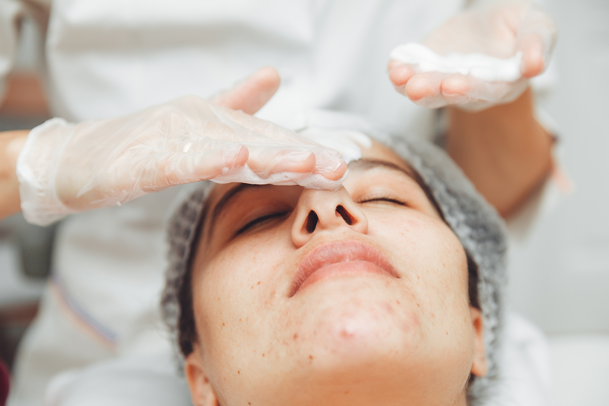 Acne Scars Procedures - COSMOCITY Clinic